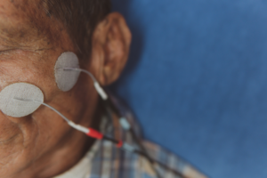 Paralysie de Bell : quels sont les vrais signes d’alerte